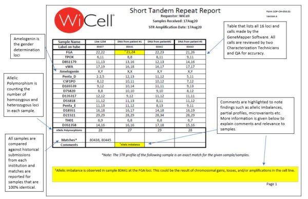 Interpreting Your STR Results » WiCell