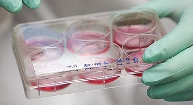Interpreting your SNP Microarray Results - WiCell Interpreting your SNP Microarray Results - WiCell